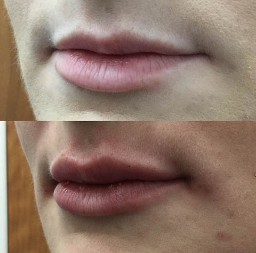 Smile Gallery - Smile With Sav